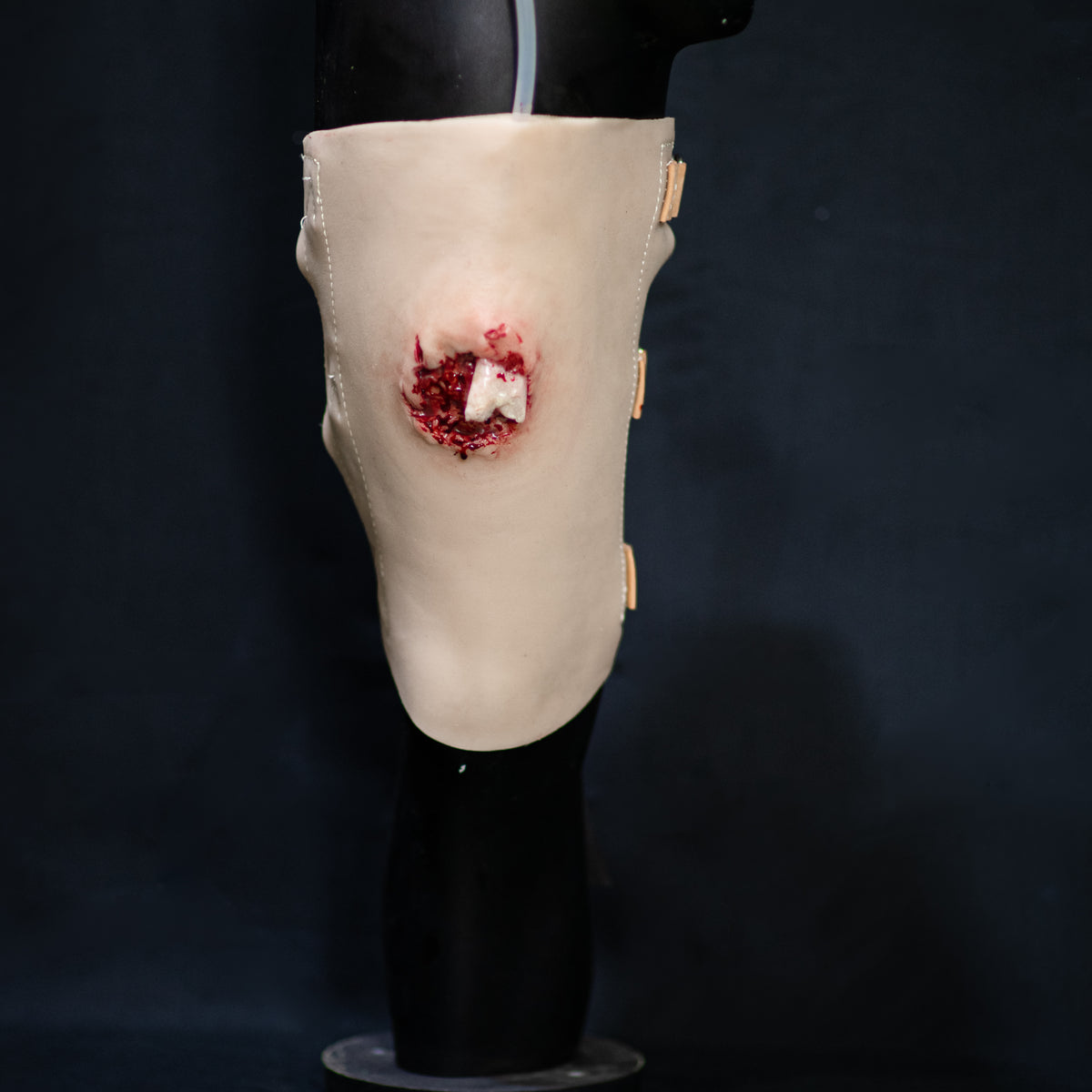 Severe Wounds – extremesimulations